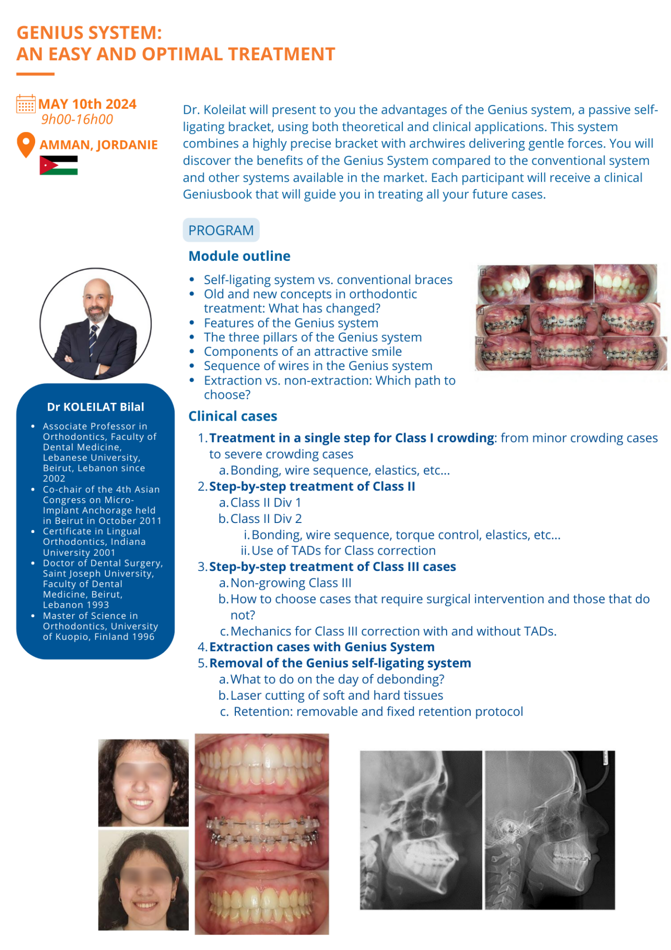 Dr Bilal KOLEILAT – GENIUS SYSTEM: AN EASY AND OPTIMAL TREATMENT – Amman, Jordanie – ORTHO PARTNER